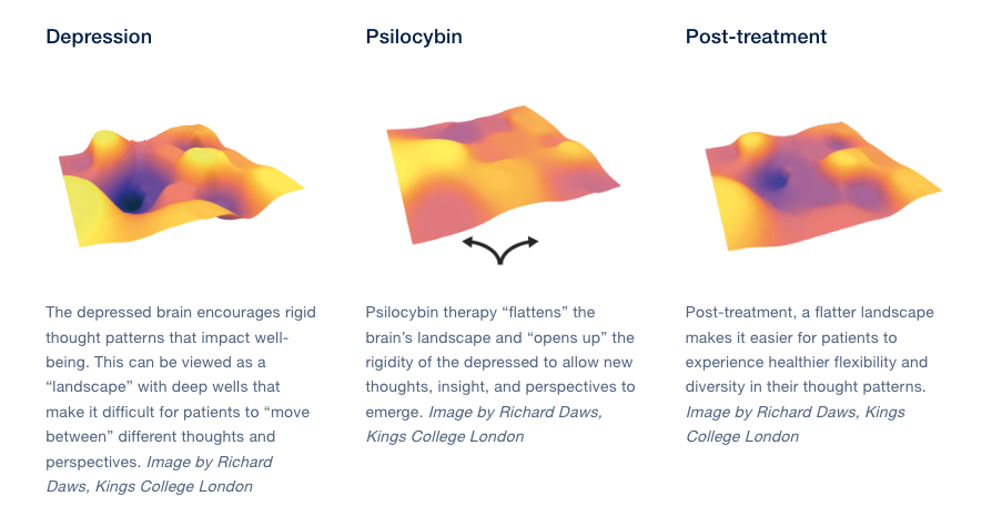 Psilocybin rewires the brain for people with depression | UCSF ...